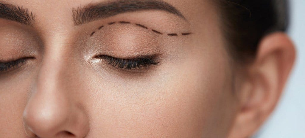 Botox or Eyelid Surgery | Women's Institute Cosmetic Surgery